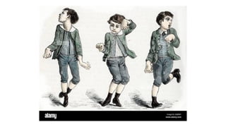 INVOLUNTARY MOVEMENT DISORDER - CHOREA AND ATHETOSIS | PPTX