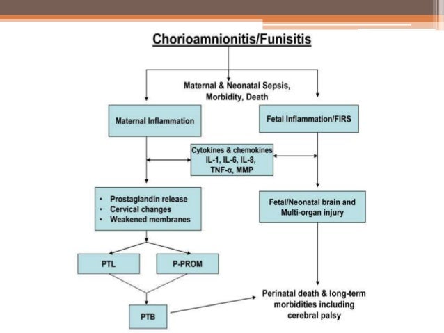 Chorioamnionitis