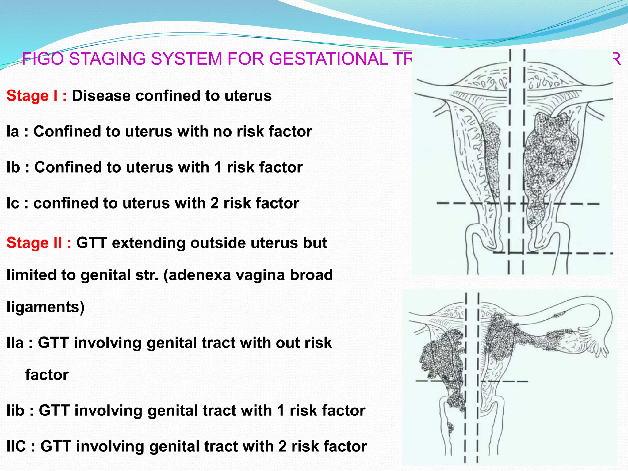 choriocarcinoma ppt.pptx