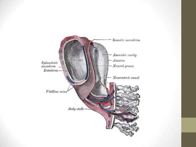 Chorionic villus sampling | PPTX