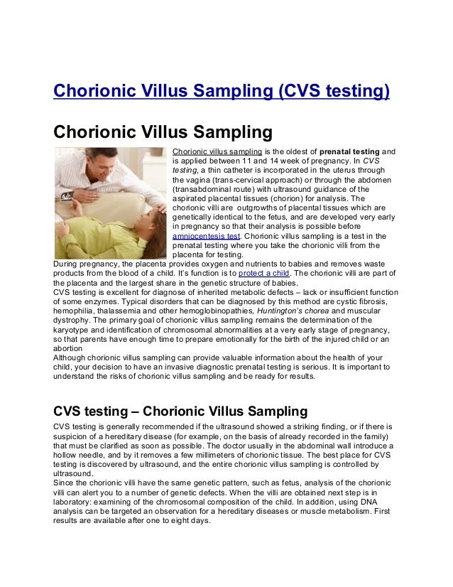 Chorionic villus sampling (cvs testing)