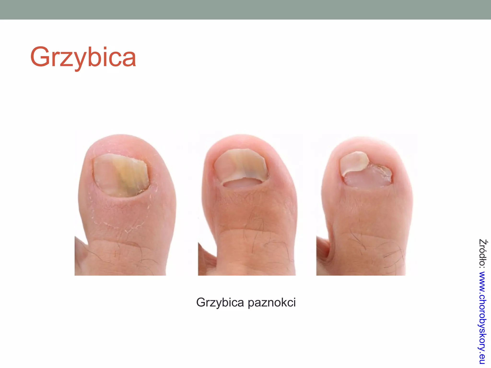 Choroby skóry | PPT