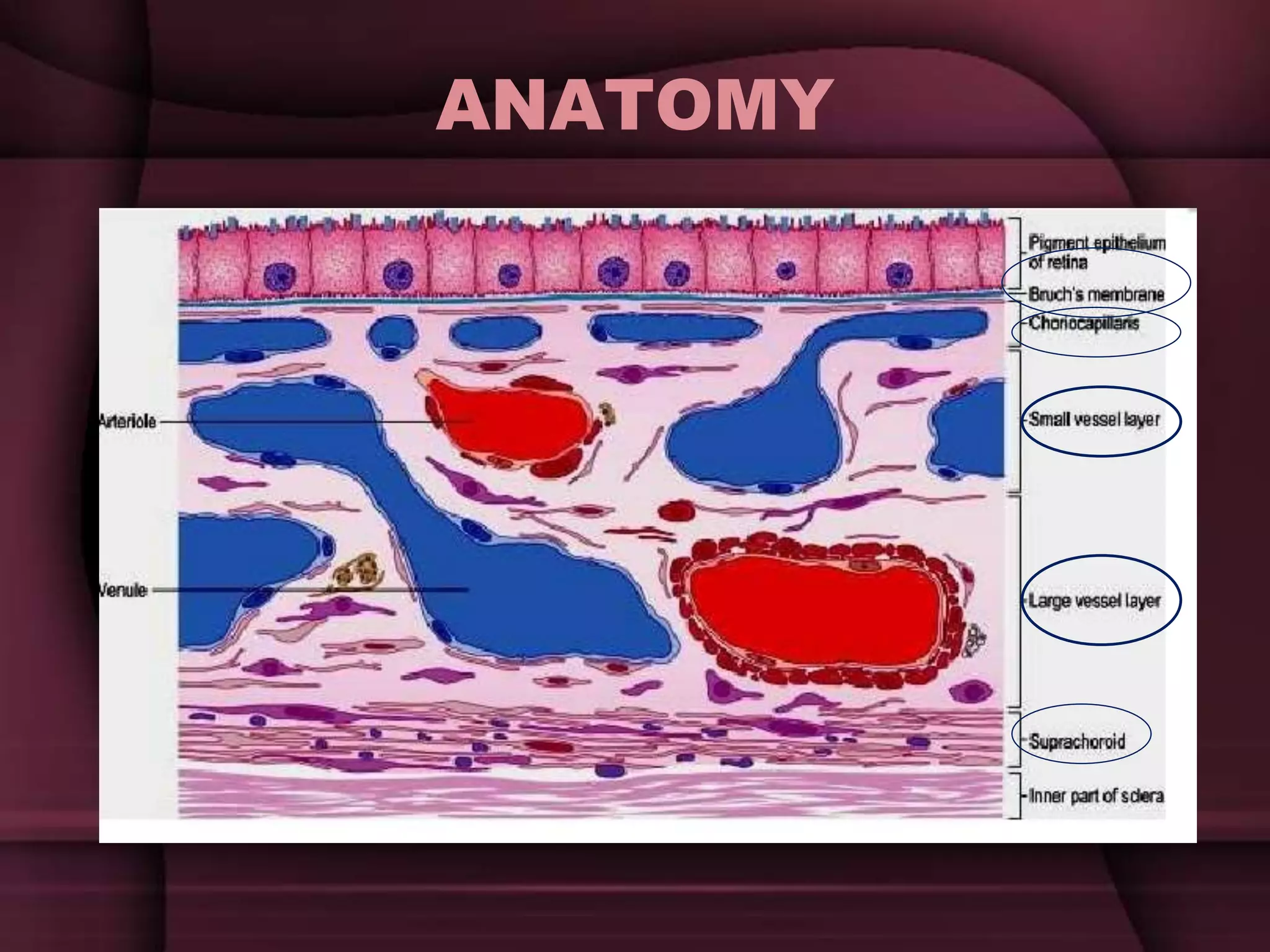 Choroidal detachment | PPTX