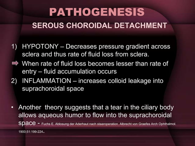 Choroidal detachment | PPTX | Eye and Vision Conditions | Diseases and ...