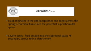Choroidal detachment -Nov 2017 | PPTX