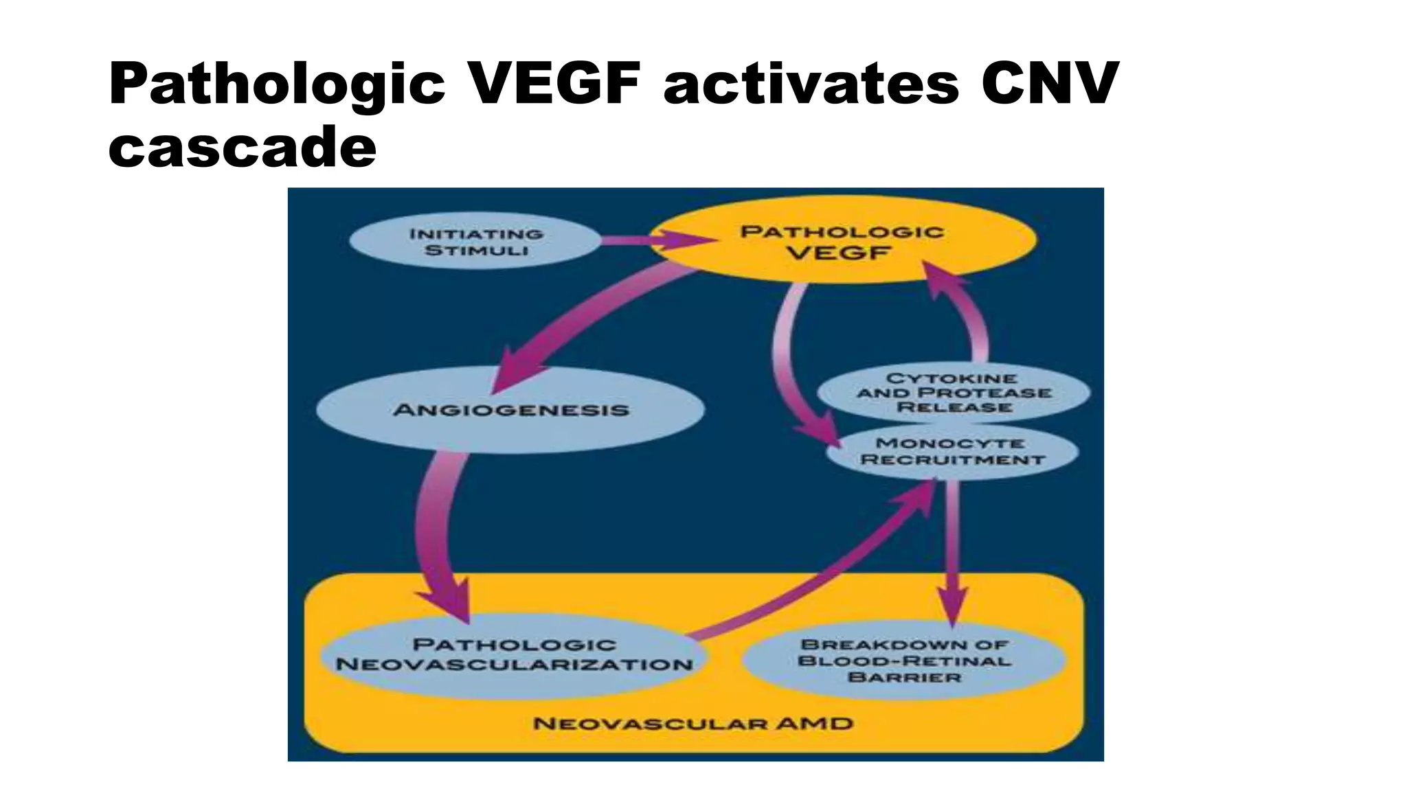Choroidal neovascularisation(cnv) | PPTX
