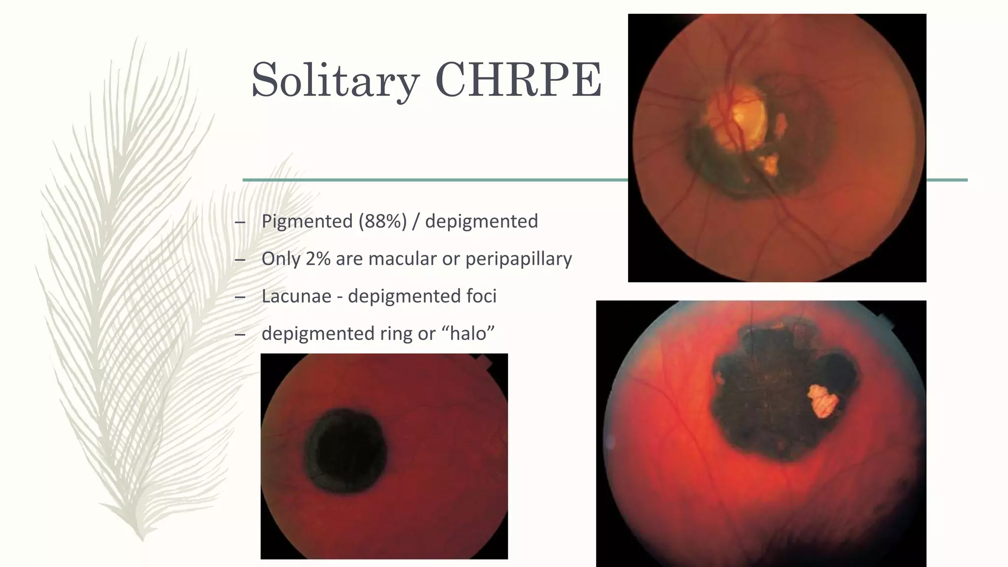 Choroidal nevus and chrpe | PPTX