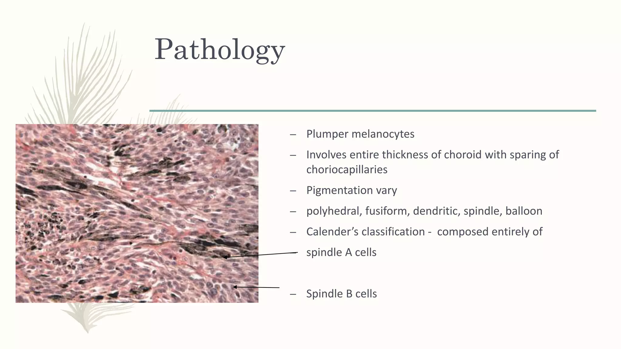 Choroidal nevus and chrpe | PPTX