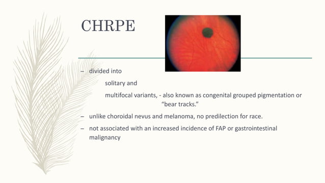 Choroidal nevus and chrpe | PPT