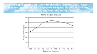 Choroidal thickness in normal eyes journal critique | PPTX