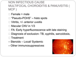 Choroiditis | PPTX