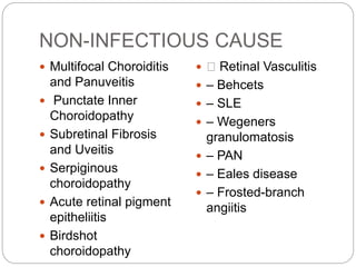 Choroiditis | PPTX