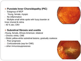 Choroiditis | PPT