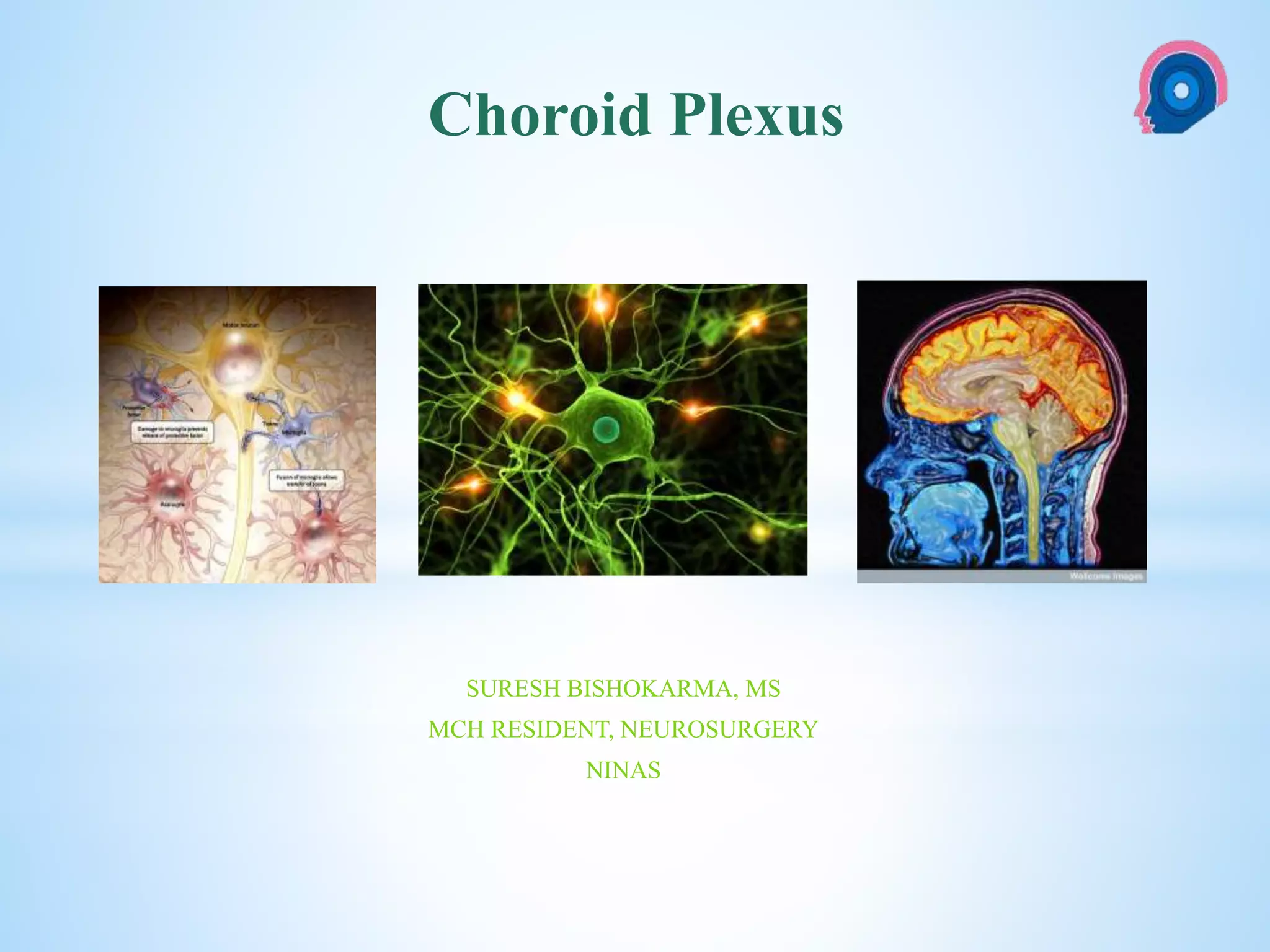 Choroid plexus | PPTX