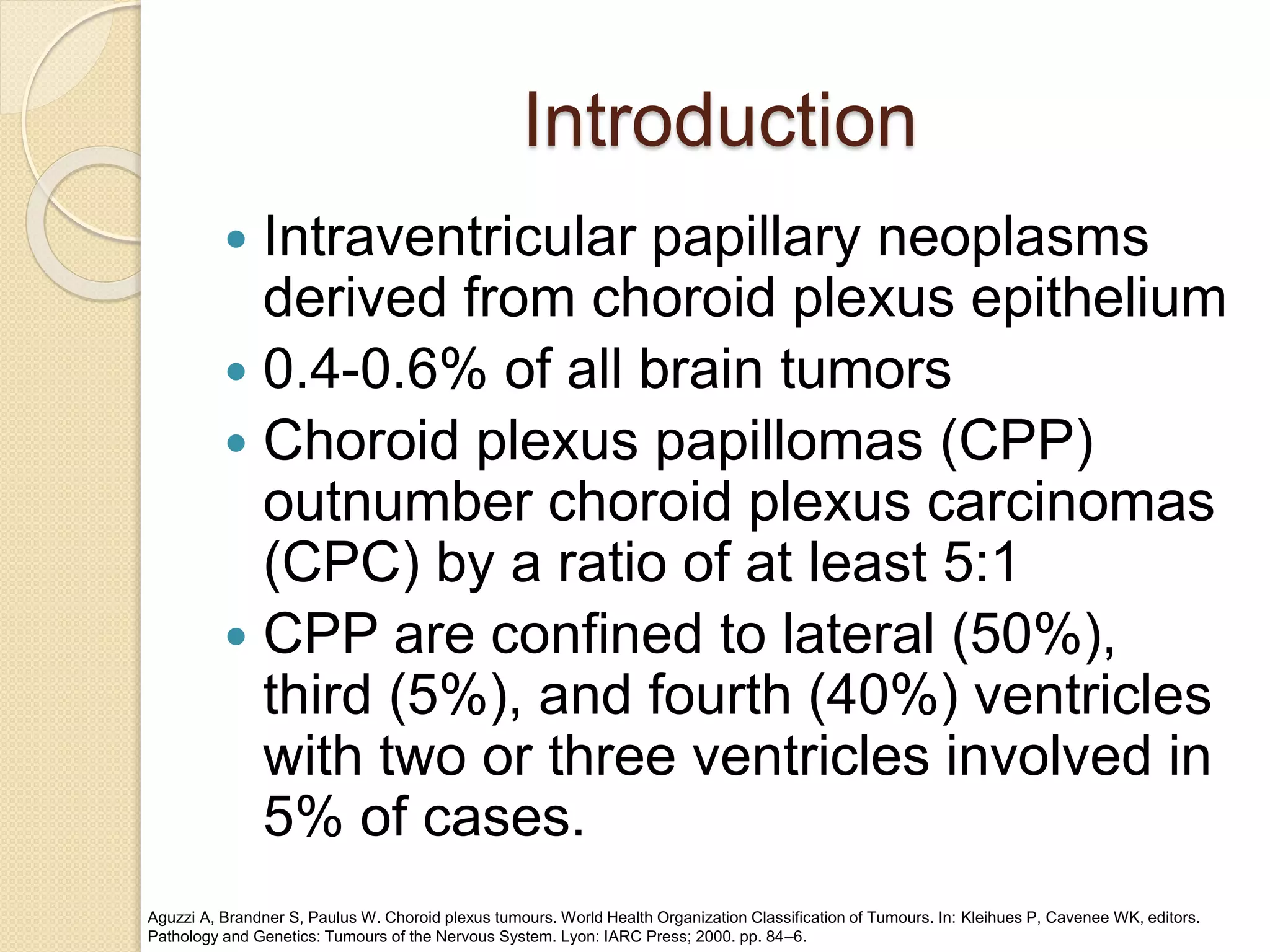 Choroid Plexus Papilloma | PPTX