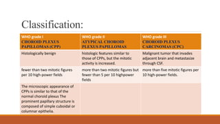 CHOROID PLEXUS PAPILLOMAS Presentation.. | PPTX