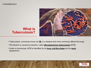 Tuberculosis presentation for medical students | PPTX