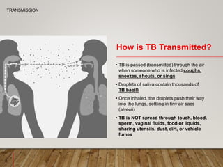 Tuberculosis presentation for medical students | PPTX