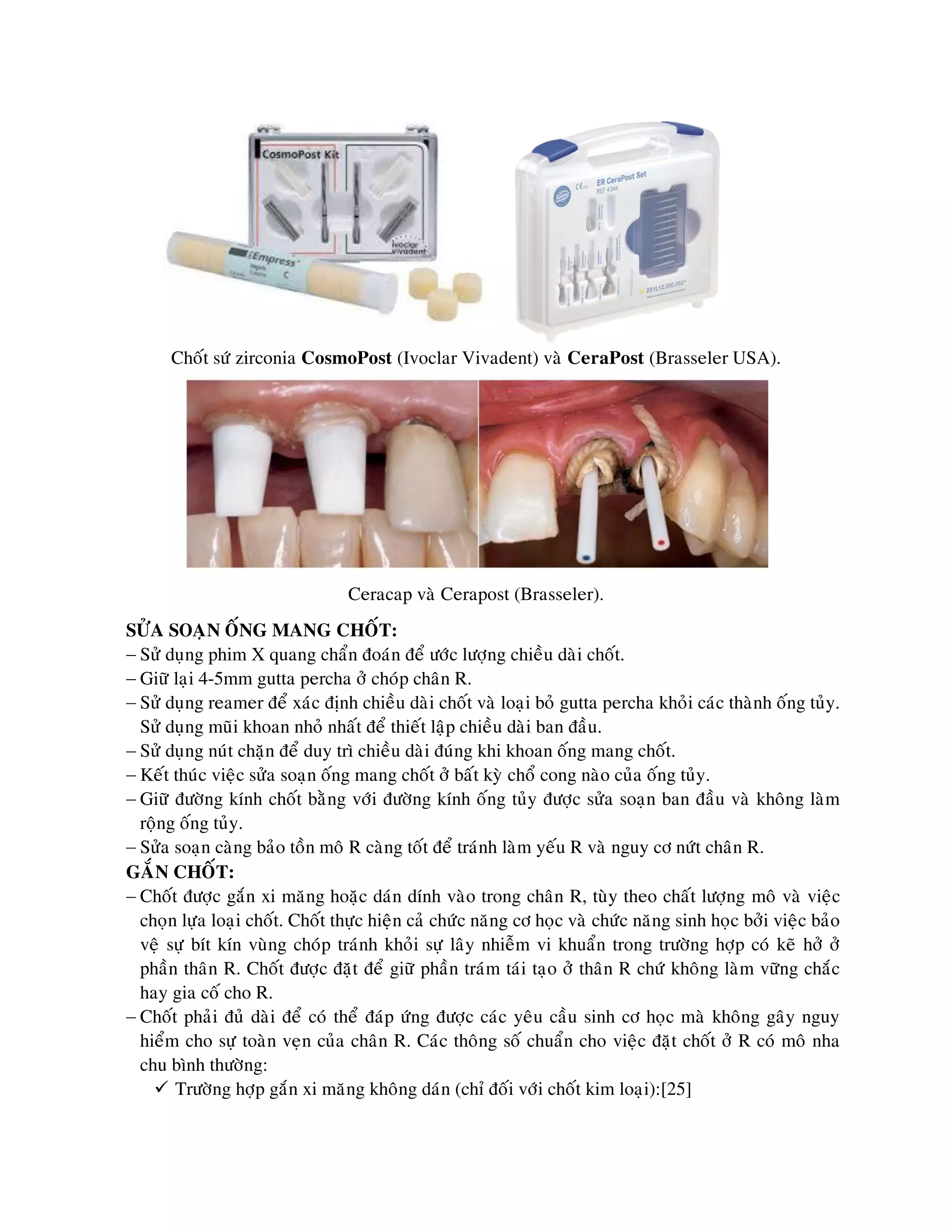 Chot trong nha khoa | PDF