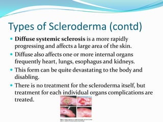 Chp 3 skin terms presentation | PPT