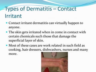 Chp 3 skin terms presentation | PPT