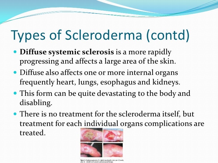 Chp 3 skin terms presentation