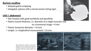 Congenital Hypertrophic Pyloric Stenosis | PPT