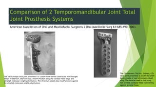 Christensen prosthesis | PPTX