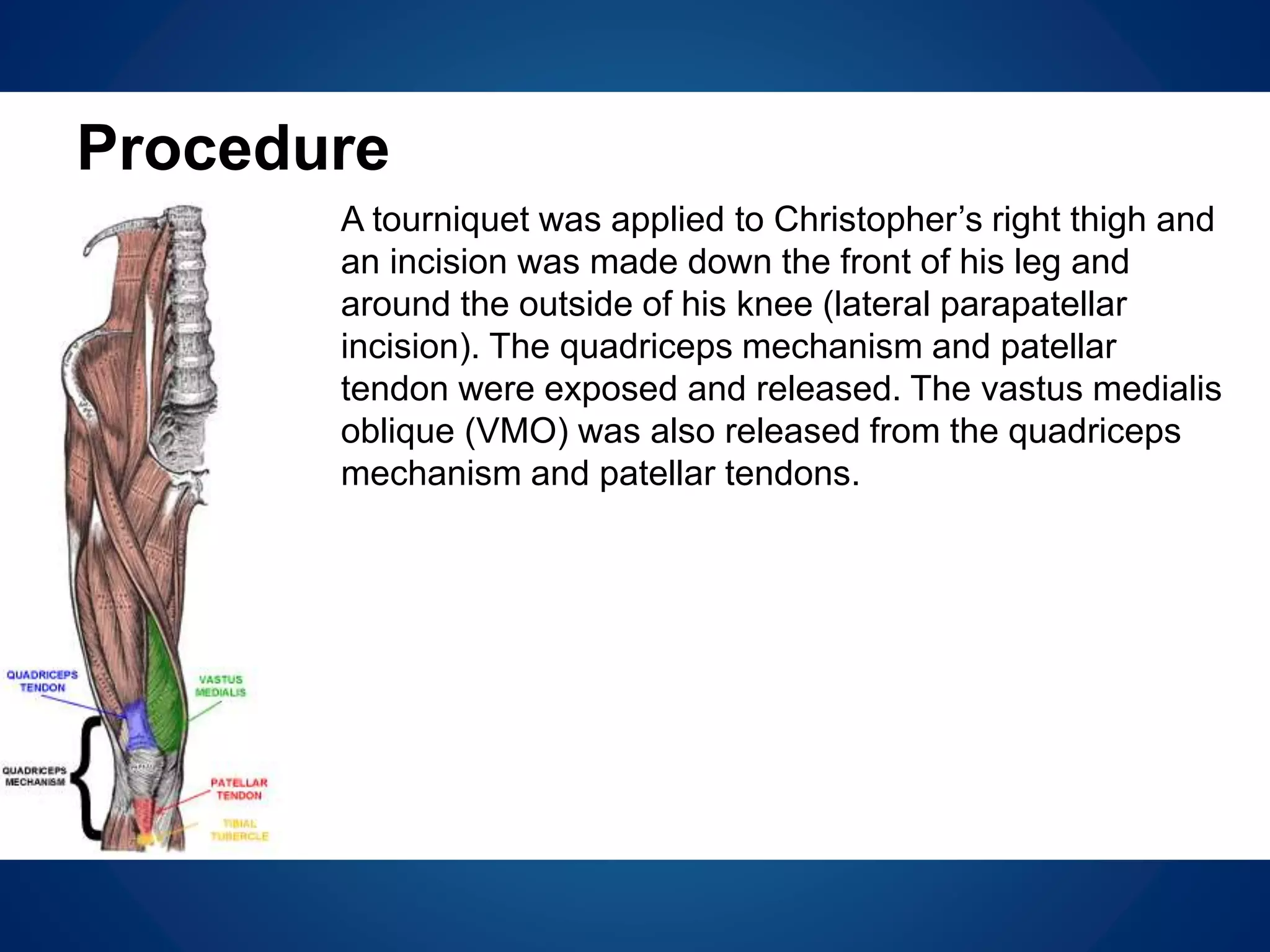 Christopher: Knee Pain, Severe Crouch Gait, & Hip Flexion Contracture ...