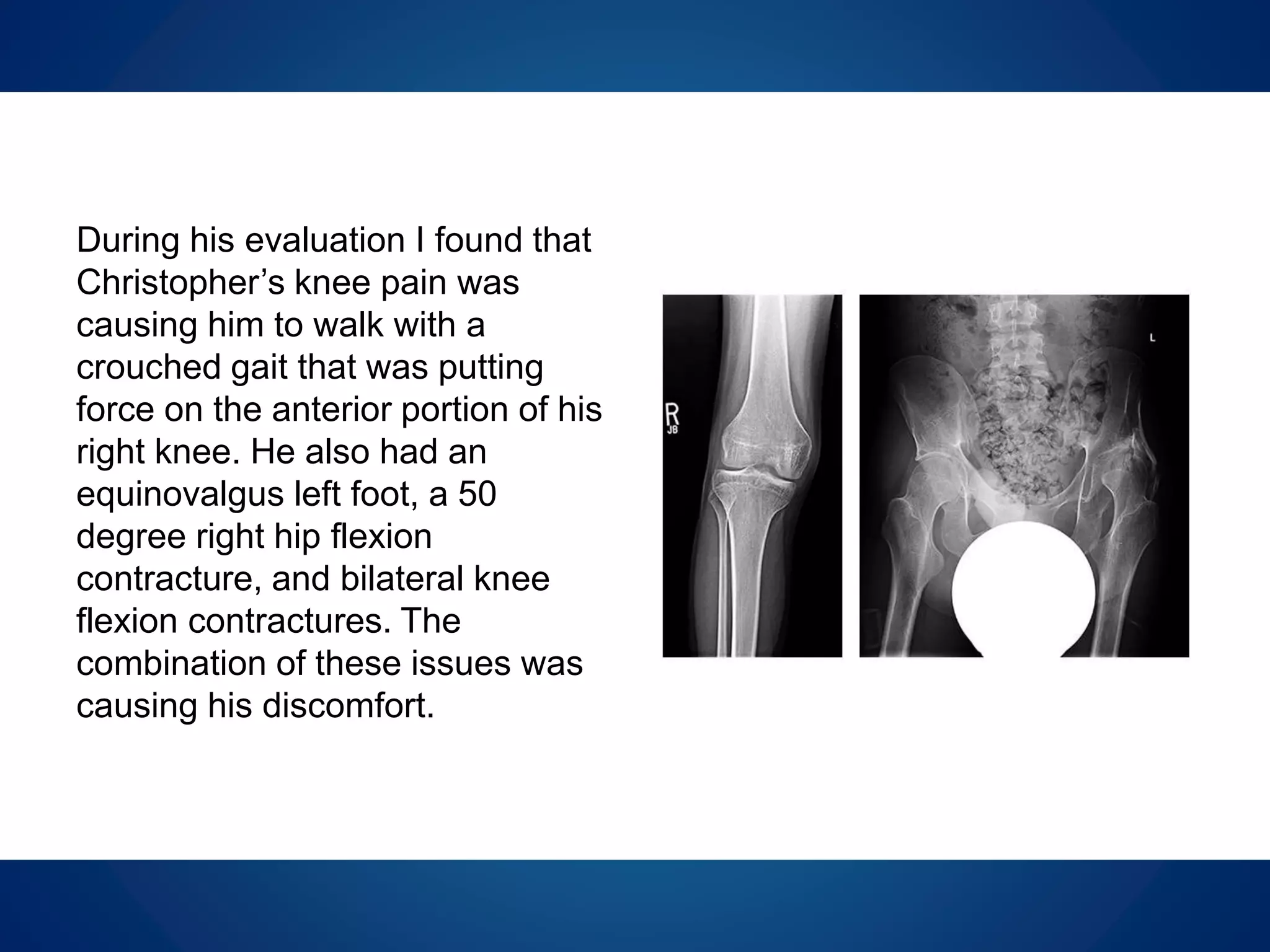 Christopher: Knee Pain, Severe Crouch Gait, & Hip Flexion Contracture ...