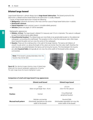 Christopher_Clarke,_Anthony_Dux_Abdominal_X_rays_for_Medical_Students.pdf
