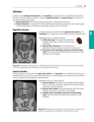 Christopher_Clarke,_Anthony_Dux_Abdominal_X_rays_for_Medical_Students.pdf