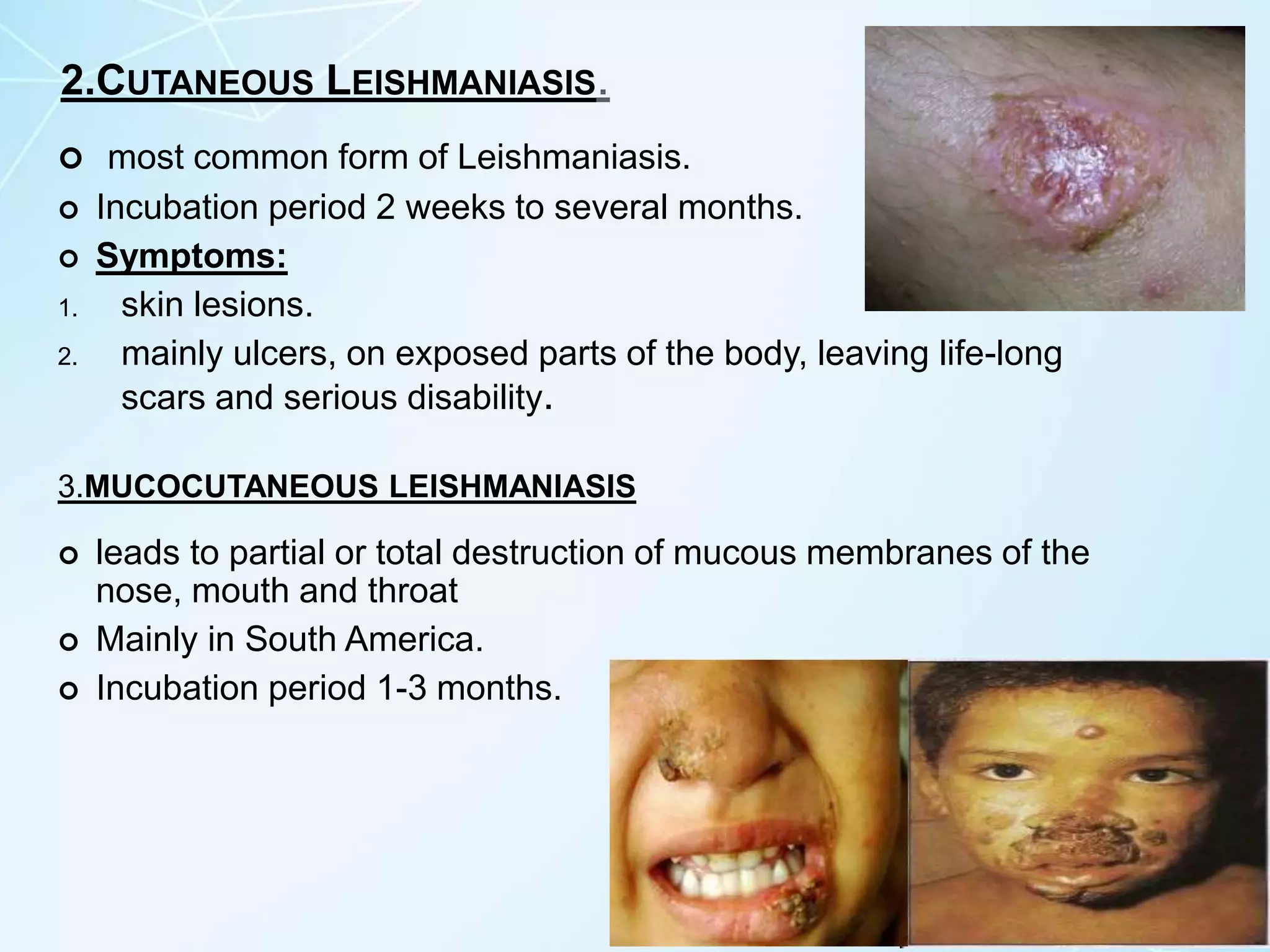 case presentation on post kala azar dermal leishmaniasis (PKDL) | PPTX