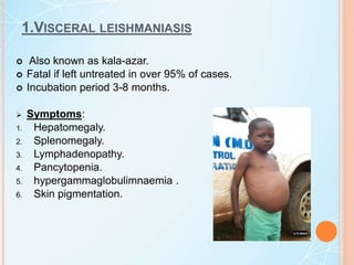 case presentation on post kala azar dermal leishmaniasis (PKDL) | PPTX