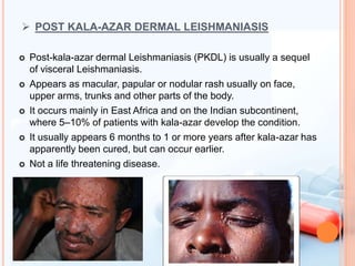 Post Kala Azar Dermal Leishmaniasis