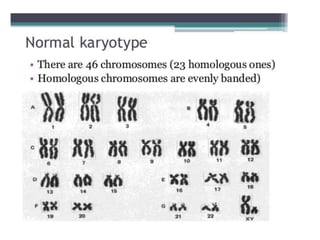 chromo abnormality.pptx