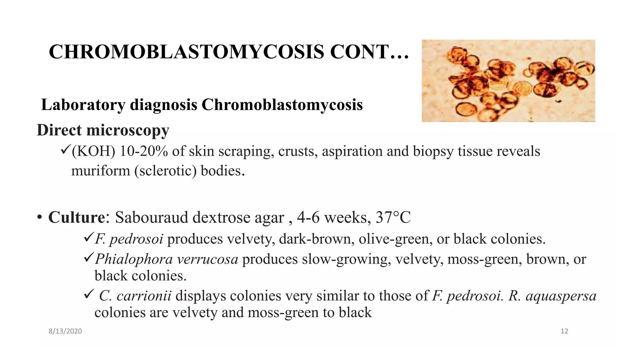 Chromoblastomycosis and phaeohyphomycosis | PPTX