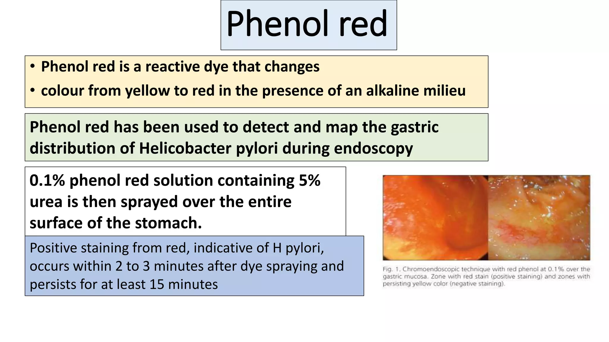 Chromoendoscopy | PPTX