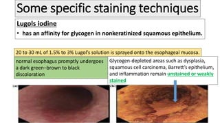 Chromoendoscopy | PPTX