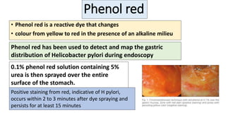 Chromoendoscopy | PPTX