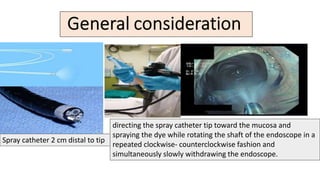 Chromoendoscopy | PPTX