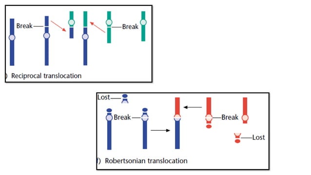Chromosomal-Abnormalitiesssss,abnormal.pptx