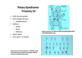 Chromosomal-disorders.pdfclass 12 investigation project | PDF
