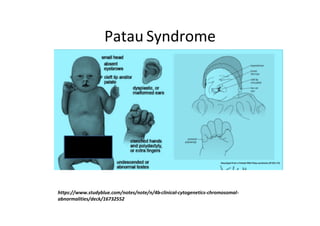 Chromosomal-disorders.pdfclass 12 investigation project | PDF