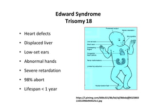 Chromosomal-disorders.pdfclass 12 investigation project | PDF