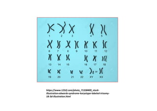 Chromosomal-disorders.pdfclass 12 investigation project | PDF
