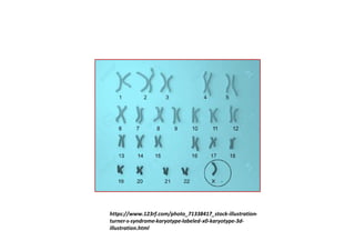 Chromosomal-disorders.pdfclass 12 investigation project | PDF