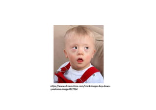 Chromosomal-disorders.pdfclass 12 investigation project | PDF