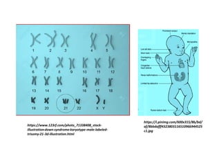 Chromosomal-disorders.pdfclass 12 investigation project | PDF