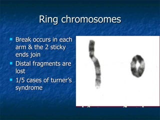 Chromosomal Aberrations | PPT